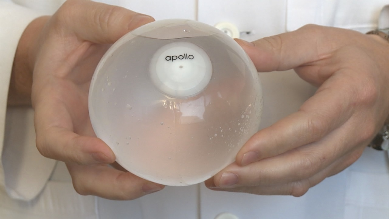 Unveiling the Science Behind the Orbera Balloon for Weight Management ...